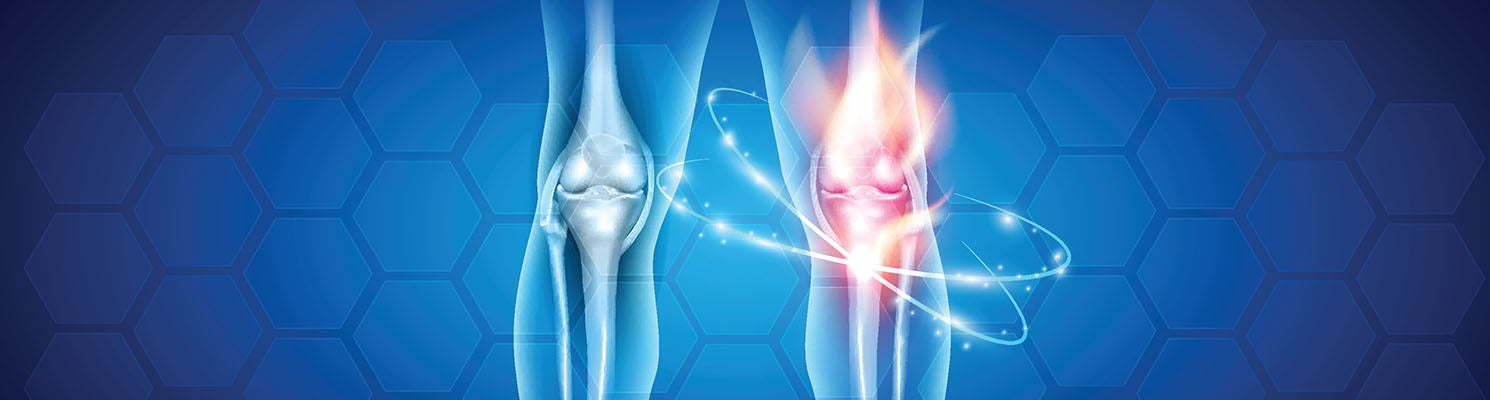 Arthroscopic Meniscal Repair | Trinity Health Mid-Atlantic